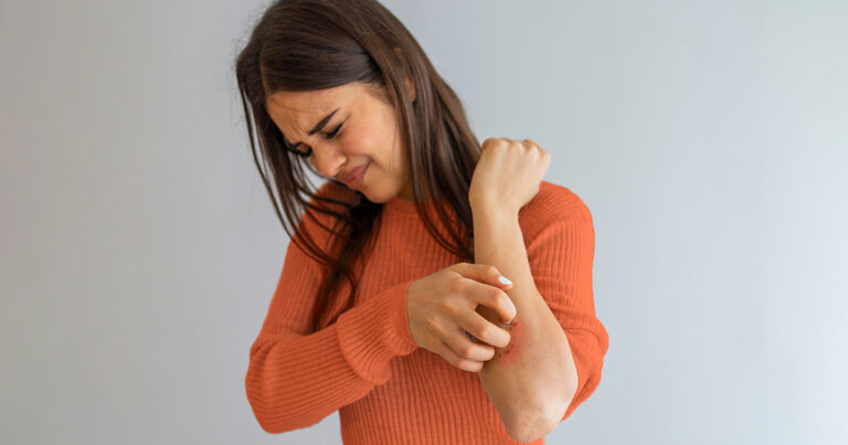 Rashes That Look Like Ringworm But Aren’t - vybe urgent care